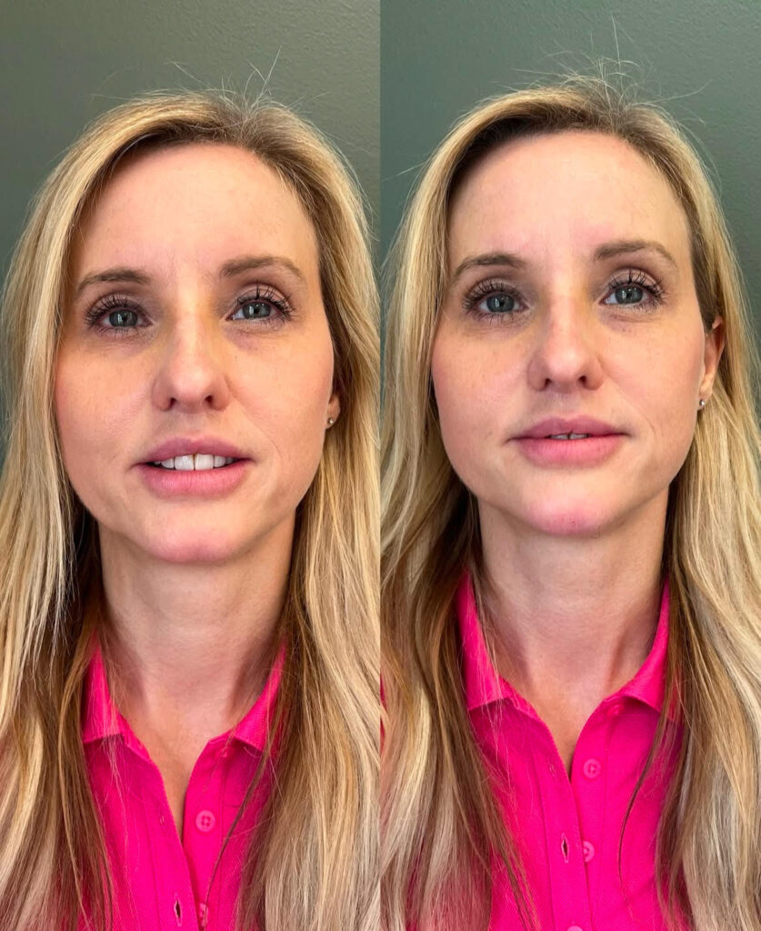 Before and After Gallery – The Artistry NP