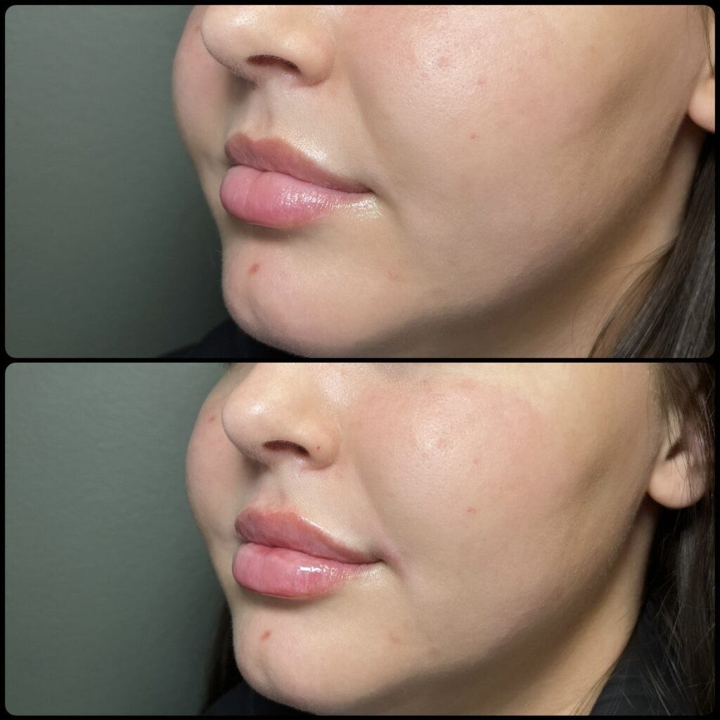Before And After Gallery The Artistry NP before-and-after-gallery-the-artistry-np